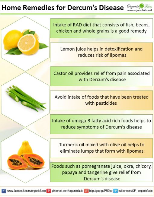 Home Remedies for Dercum's Disease | Organic Facts