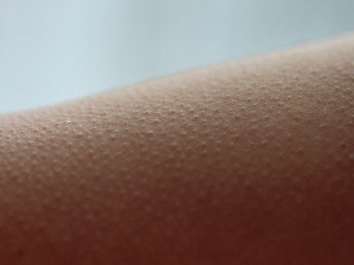 Harvard Study Explores Why We Get Goosebumps | Organic Facts