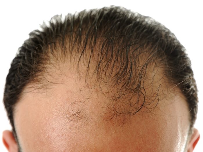 7 Best Benefits of Pygeum | Organic Facts