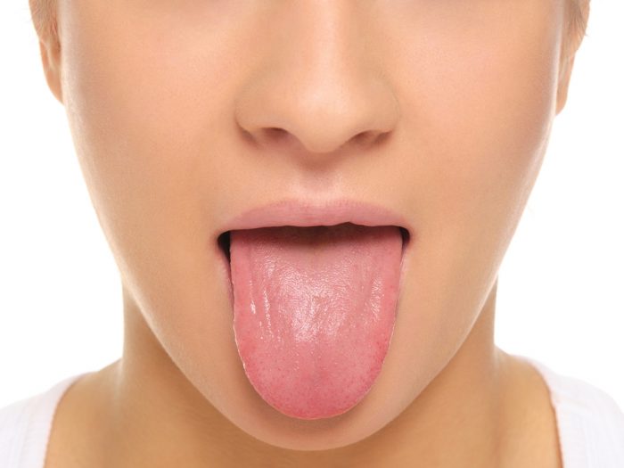 8 Best Treatments For Tingling Tongue Organic Facts 8 Best Treatments For Tingling Tongue Organic Facts